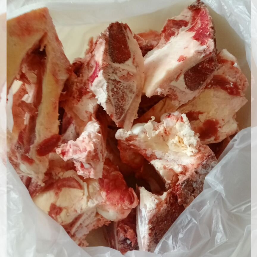 Грудной хрящ