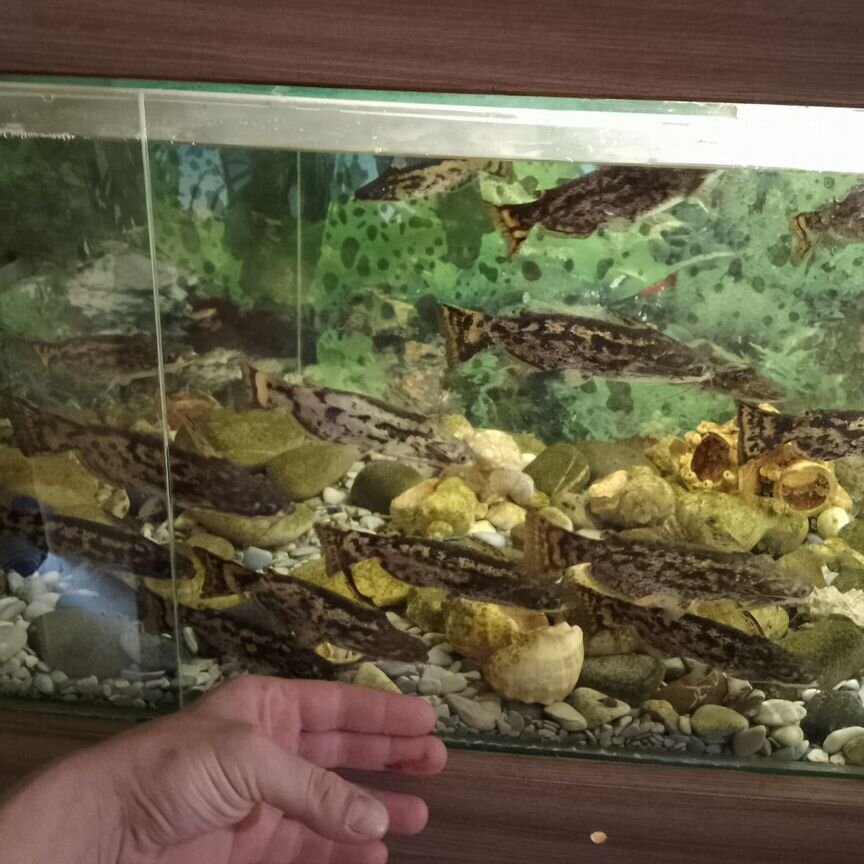 Сомы Фишера, здоровые