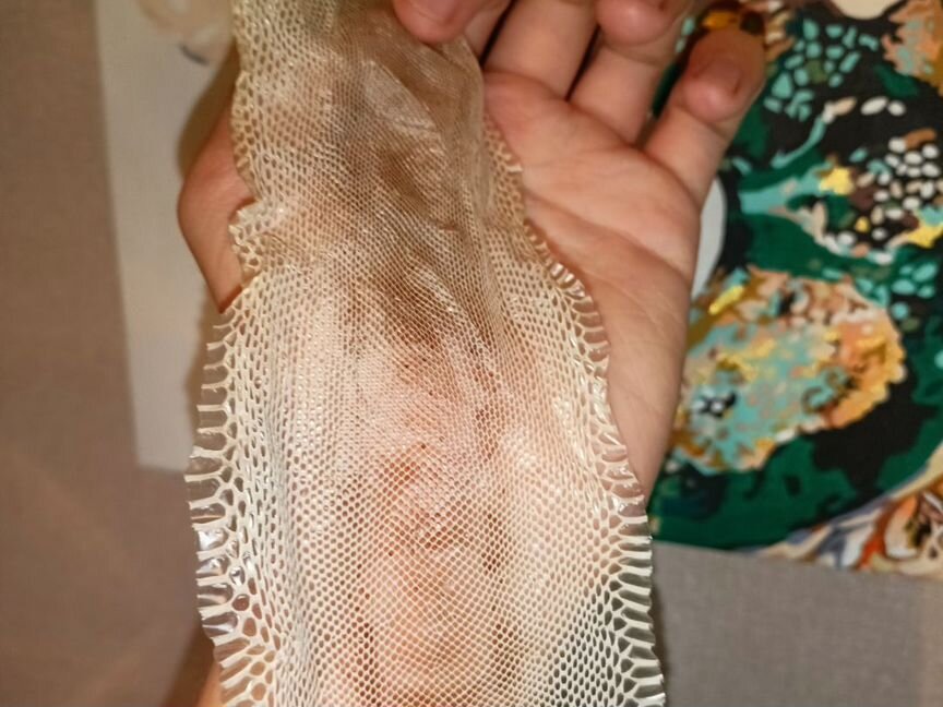 Линька,кожа